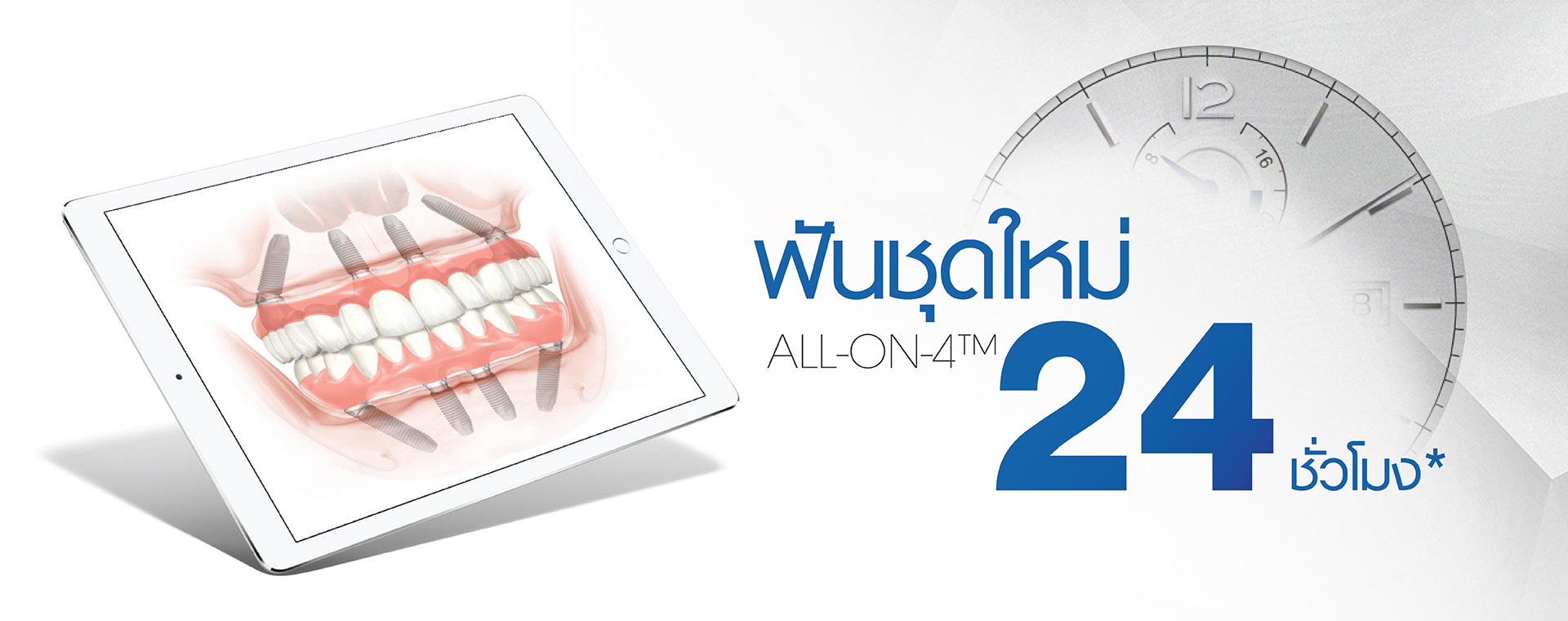 ออลออนโฟร์ ฟันชุดใหม่ ใน 24 ชั่วโมง คลินิกทันตกรรม คลินิกจัดฟัน รากฟัน ...